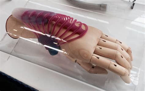 My Arm Wrist Brace Device Concept Multi Material Voxel Based ‪ ‎3dprint‬ For Metamason On