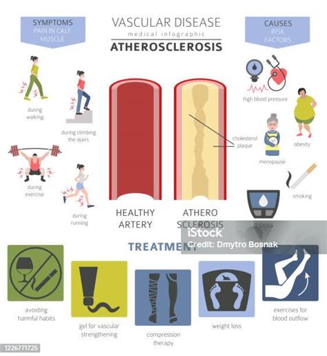 Penyakit Pembuluh Darah Gejala Aterosklerosis Set Ikon Perawatan Desain