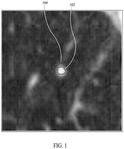 Lesion Detection Patented Technology Retrieval Search Results Eureka