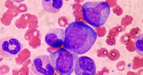 항체 치료 받은 늙은 쥐 면역체계 다시 젊어졌다