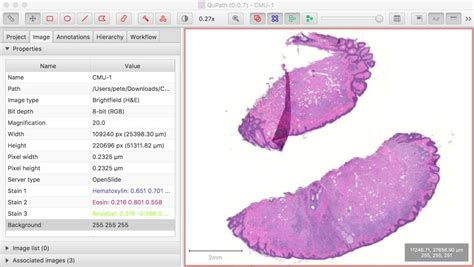 Preprocessing · Qupath Qupath Wiki · Github