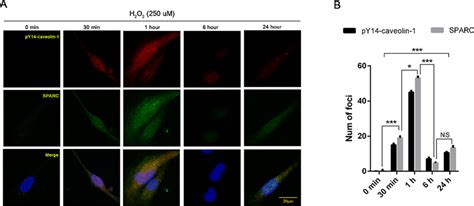 Intracellular Co Localized Expression Of Phosphorylated Caveolin 1