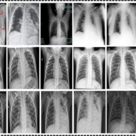 Concept Of Fine Tuning And Feature Extraction Download Scientific Diagram