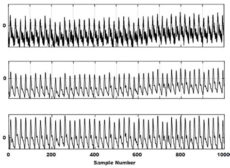 A System For Continuous Estimating And Monitoring Cardiac Output Via Arterial Waveform Analysis