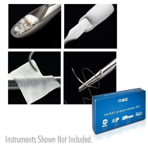 Socket Preservation Bone Grafting Ace Southern