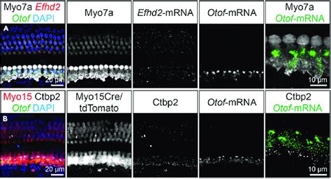 Examples For Hybridization Chain Reaction In Situ Mrna Detection Download Scientific Diagram