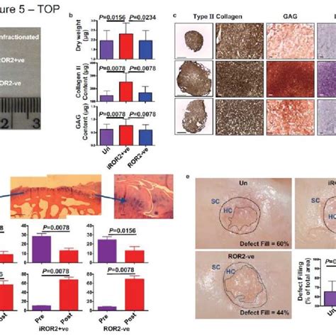 Intersubject Variability Pattern Of The Brains Functional Connectivity