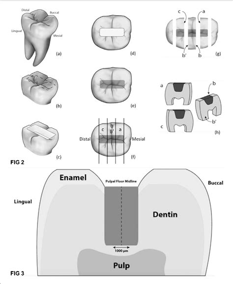 Figure 2 From Comparison Of Internal Adaptation Of Bulk Fill And Increment Fill Resin Composite