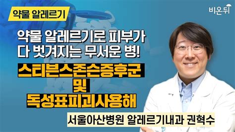 약물 알레르기로 피부가 다 벗겨지는 무서운 병 스티븐스존슨증후군 및 독성표피괴사용해 서울아산병원 알레르기내과 권혁수 Youtube