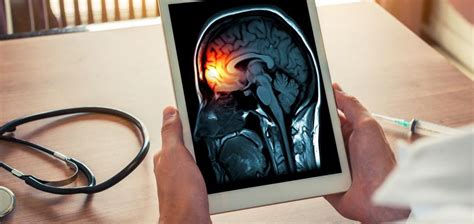 Meningite Como é A Prevenção E O Tratamento Da Doença Ciencia