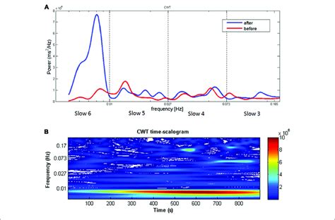 A Continuous Wavelet Transform Cwt Reaction Time Rt Spectrogram