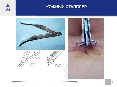 Хирургические инструменты презентация онлайн