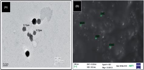 A Tem Image And B Sem Image Of Optimized Drug Loaded Nlc Formulation Download Scientific