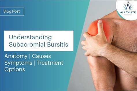 Subacromial Bursitis Diagnosis Pain Relief And Recovery