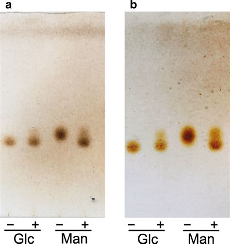 Tlc Analysis Of The Reaction Products By Runsl 4512 And Dfer 5652 Plus