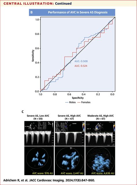 Diagnostic Value Of Aortic Valve Calcification Levels In The Assessment