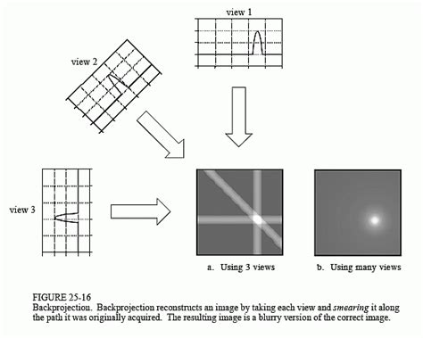 Computed Tomography