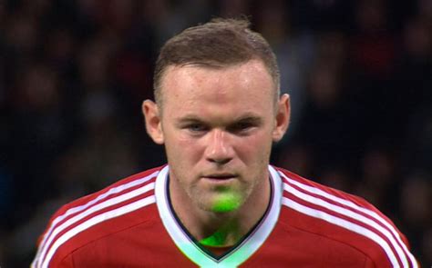 Laser Pointer Attention Deficit Disorder Prosthetic Memory Program