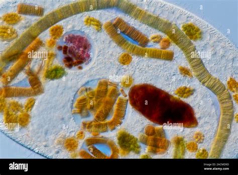 Frontonia Protist Differential Interference Contrast Micrograph Of The Large Freshwater Ciliate