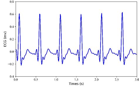Figure 13 From Reconstruction Of Missing Electrocardiography Signals