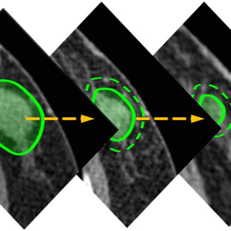 Process Of Seed Region Propagation Download Scientific Diagram