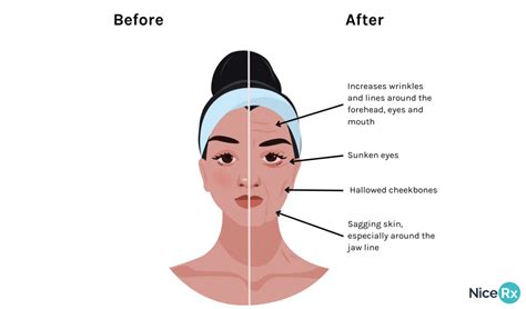 What Is Ozempic Face” And How Can You Avoid It Nicerx