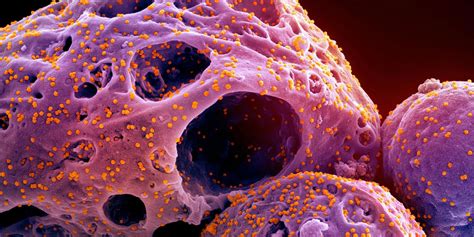 Forskare Spår Snar Pandemi Mest Rädda För ”x”