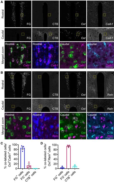 Single Neuron Projectomes Of Mouse Paraventricular Hypothalamic Nucleus Oxytocin Neurons Reveal