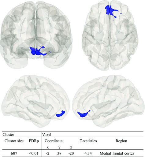 Cortical Areas Showing Decreased Connectivity With The Bilateral Download Scientific Diagram