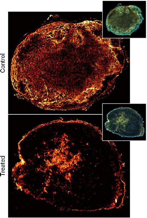 Figure 1 From 3 D Super Resolution Ultrasound Imaging For Monitoring