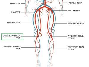 What Is The Saphenous Vein Blog Usa Vein Clinics