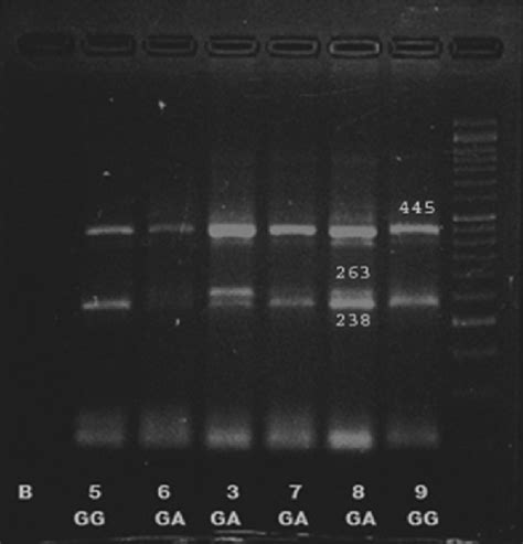 Agarose Gel Electrophoresis Of Tetra Primer Amplification Refractory Download Scientific