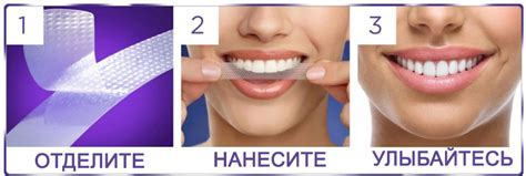 Лучшие полоски для отбеливания зубов - цена, отзывы, как пользоваться