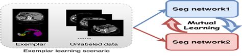 Crossmatch Enhance Semi Supervised Medical Image Segmentation With Perturbation Strategies And