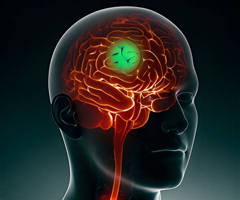 Brain Tumor Growth Could Be Slowed Down Using Non Invasive Electrical Stimulation