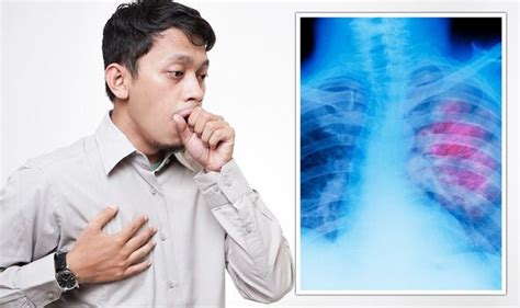 Cancer Women With Lung Cancer Likely To Experience Sexual Dysfunction Express Co Uk