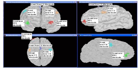 Scouts Shown On The Simulated Cortex Surface Download Scientific Diagram
