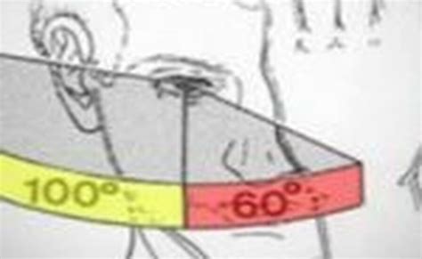Assessment Of Visual Fields NextSense