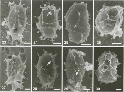 Ventral View Of Cyst With Well Developed Processes Showing The