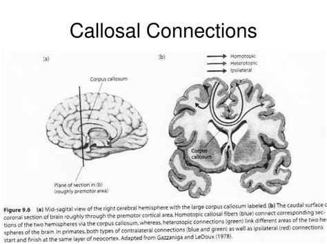Ppt Homotopic Callosal Connections Powerpoint Presentation Free Download Id5578359