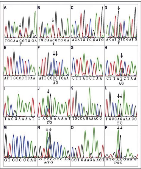 Representative Electropherograms Of Genetic Alterations In Exons 2 7 Of