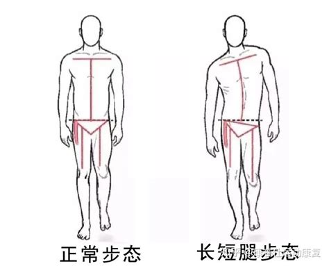 测一下，你是真的长短腿还是假的！ 知乎