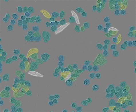 Brightfield Cell Counting Image Analysis Image Sc Forum