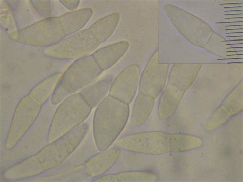 Dothideomycetes Dothideales