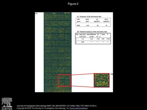 CDNA Microarray Analysis Of Gene Expression Profiles In Human Fibroblast Cells Irradiated With