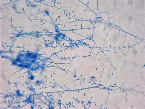 Fun With Microbiology Whats Buggin You Trichophyton Terrestre