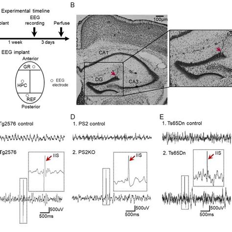 Iis Is A Robust Eeg Abnormality In Three Mouse Models Of Ad A A1 Download Scientific Diagram