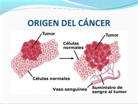 Vicipaedia Origen Del CÁncer Vicipedia