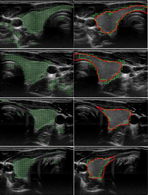 Left Column Result Of Cnn Texture Classification Right Column Download Scientific Diagram