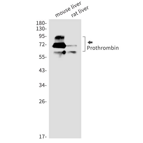Prothrombin Rabbit MAb WB IHC P Buy Now